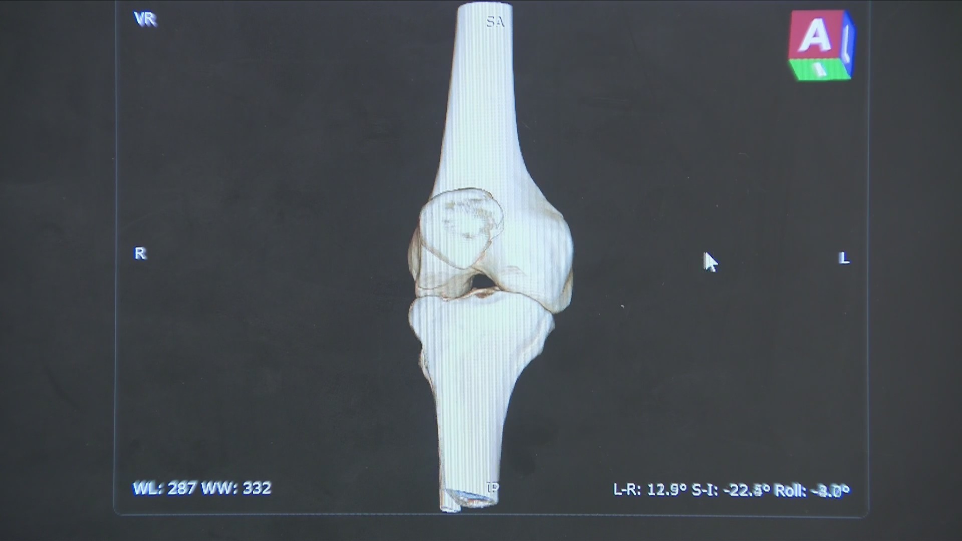 ORA Orthopedics provides new, first-of-its-kind CT scanner