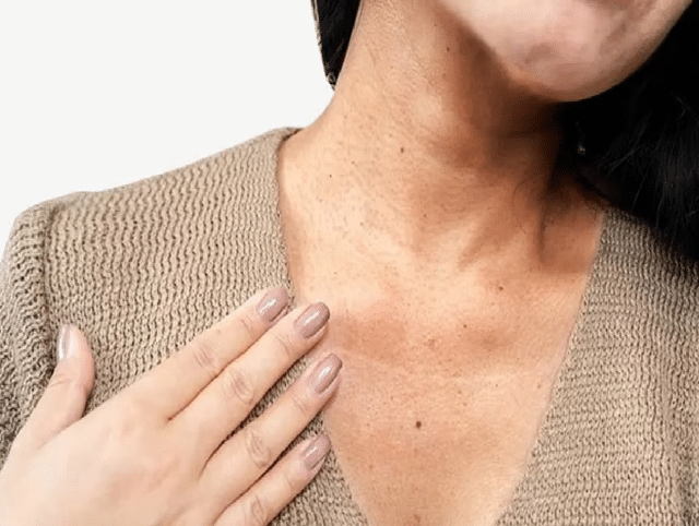 Dark skin around the neck? Don't ignore it — it could be an early sign ...