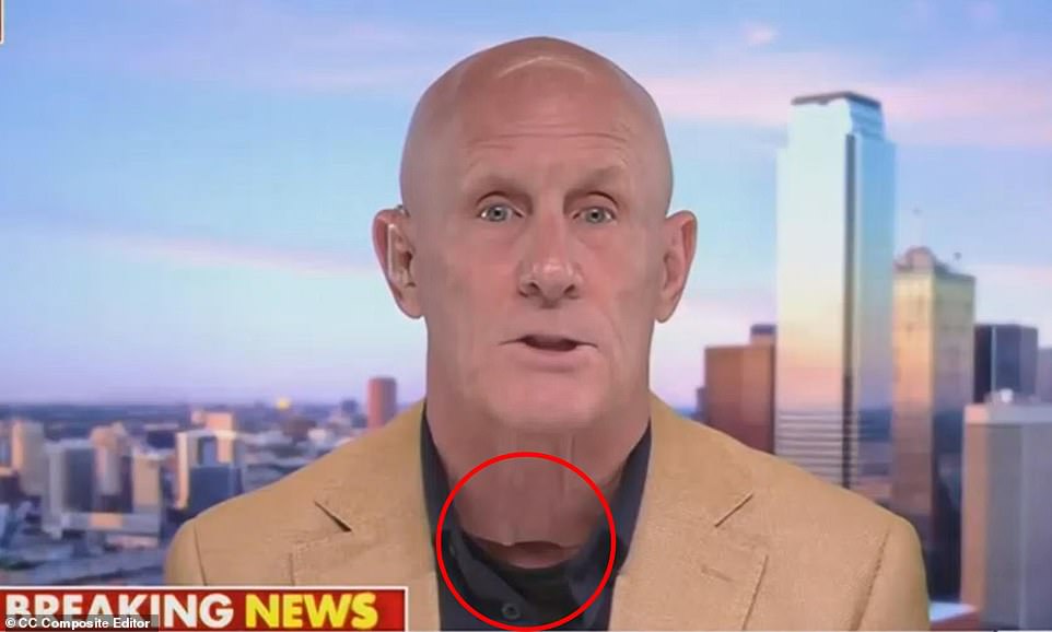 Report: Truth behind rumor Fox News guest wore head mask for appearance