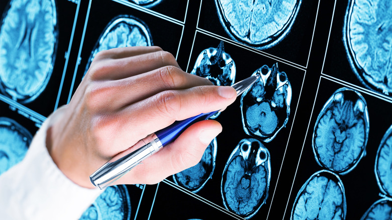 When you're in a coma, this is what happens to your body