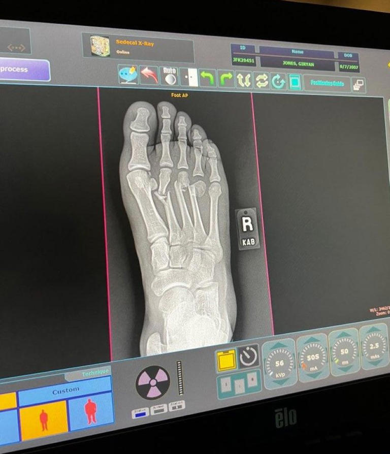 ‘I would call it a miracle’: Bonneville runner Giryan Jones recovers ...