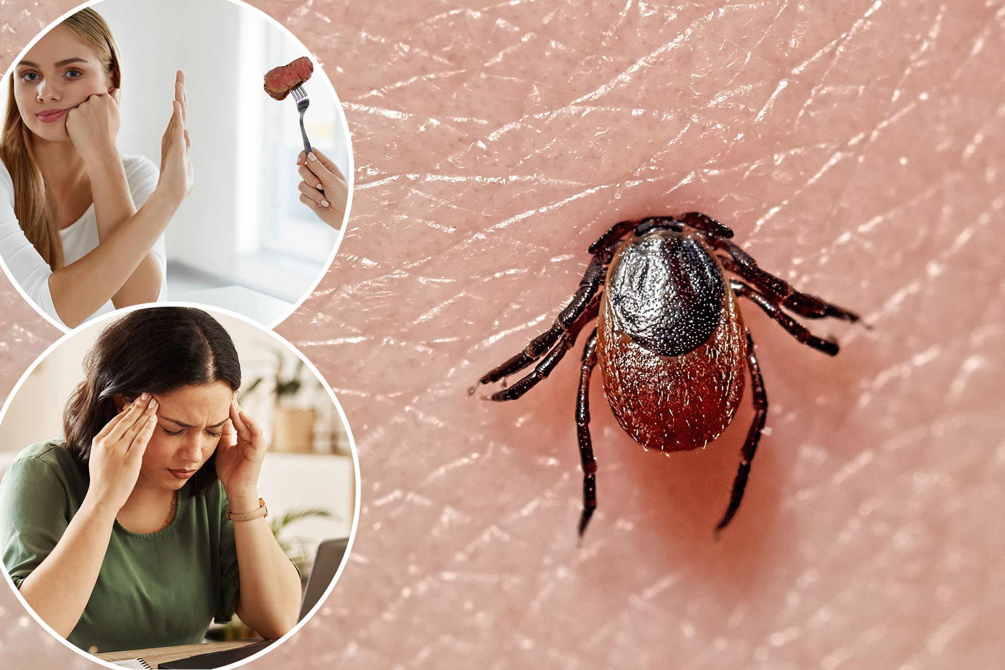 Meat allergies, confusion, vomiting — 5 diseases you can get from ticks ...