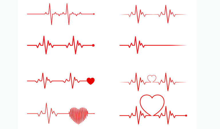 ¿Cuál es la frecuencia cardiaca normal en reposo? Depende de cada persona