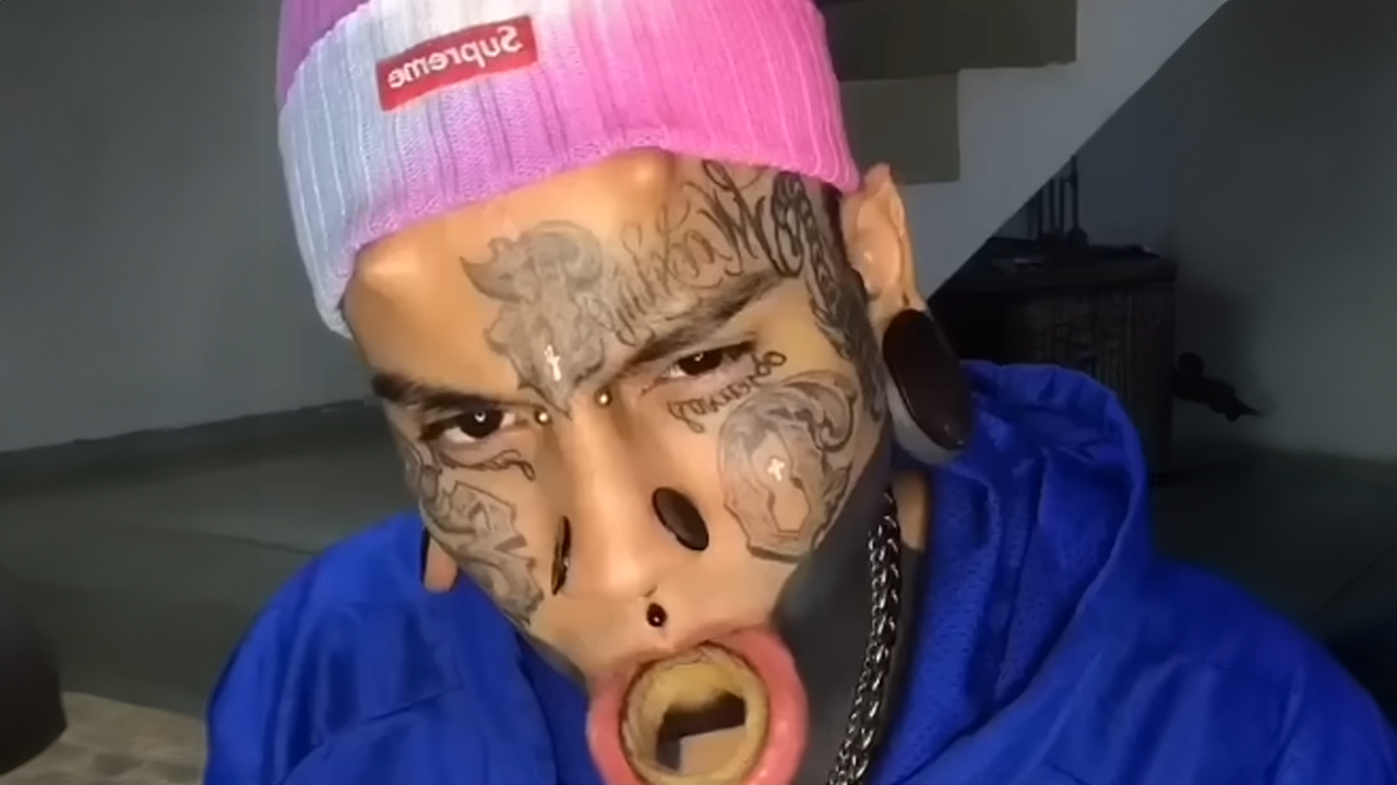 Doctor reacts to extreme body modification
