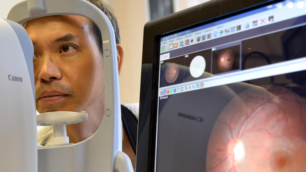 AI eye scans show promise for early osteoporosis detection
