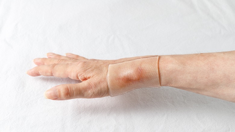 Things that really work to reduce the appearance of scars
