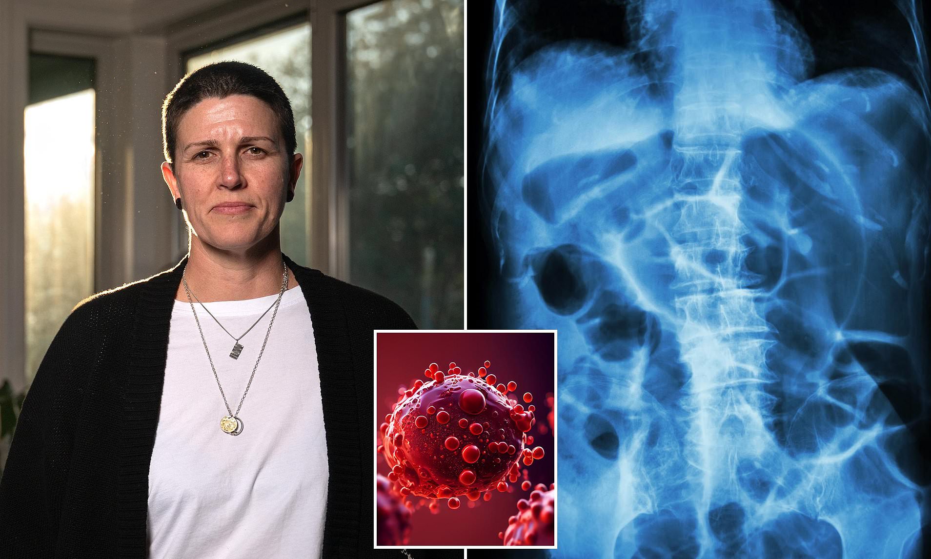 The silent symptoms mum ignored before devastating cancer diagnosis as ...