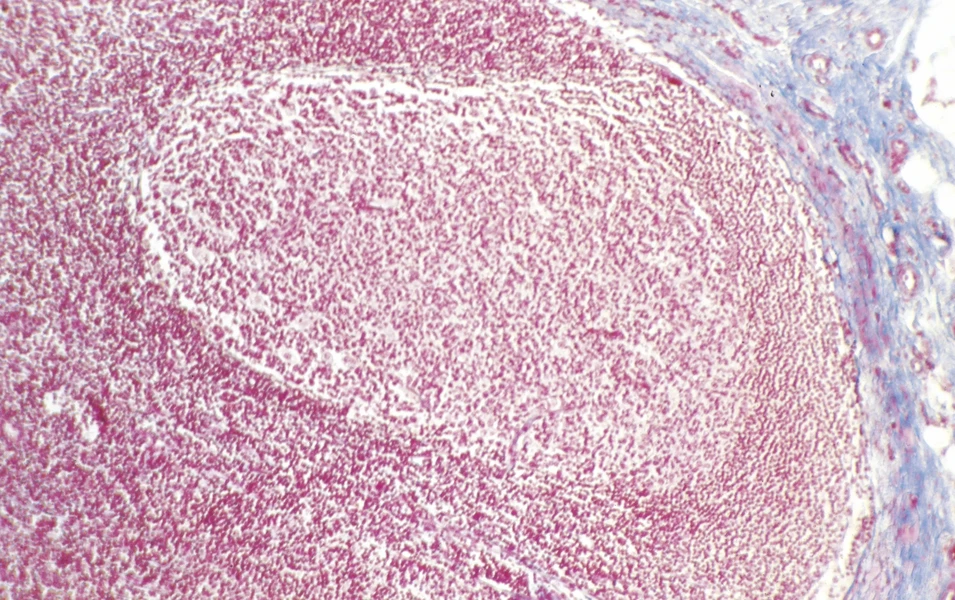 Understanding your lymph nodes and health