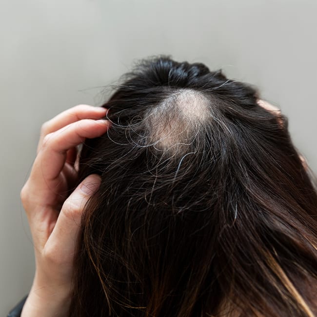 Struggling with bald spots? Stylists say these hairstyles can help hide ...