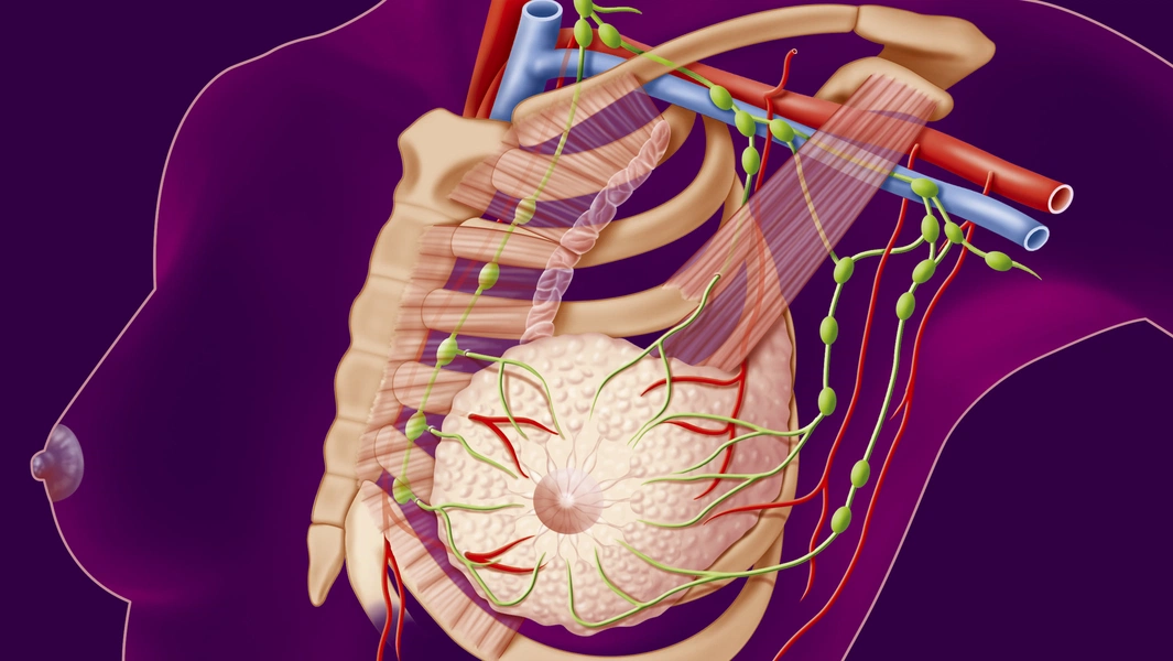 Understanding your lymph nodes and health