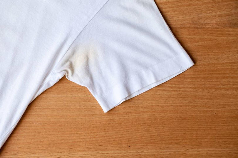 Remove yellow stains from white clothes with 2p item experts 'use for ...