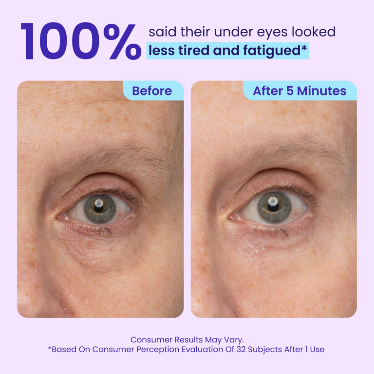 Everyone is talking about this viral eye gel that works in 5 minutes