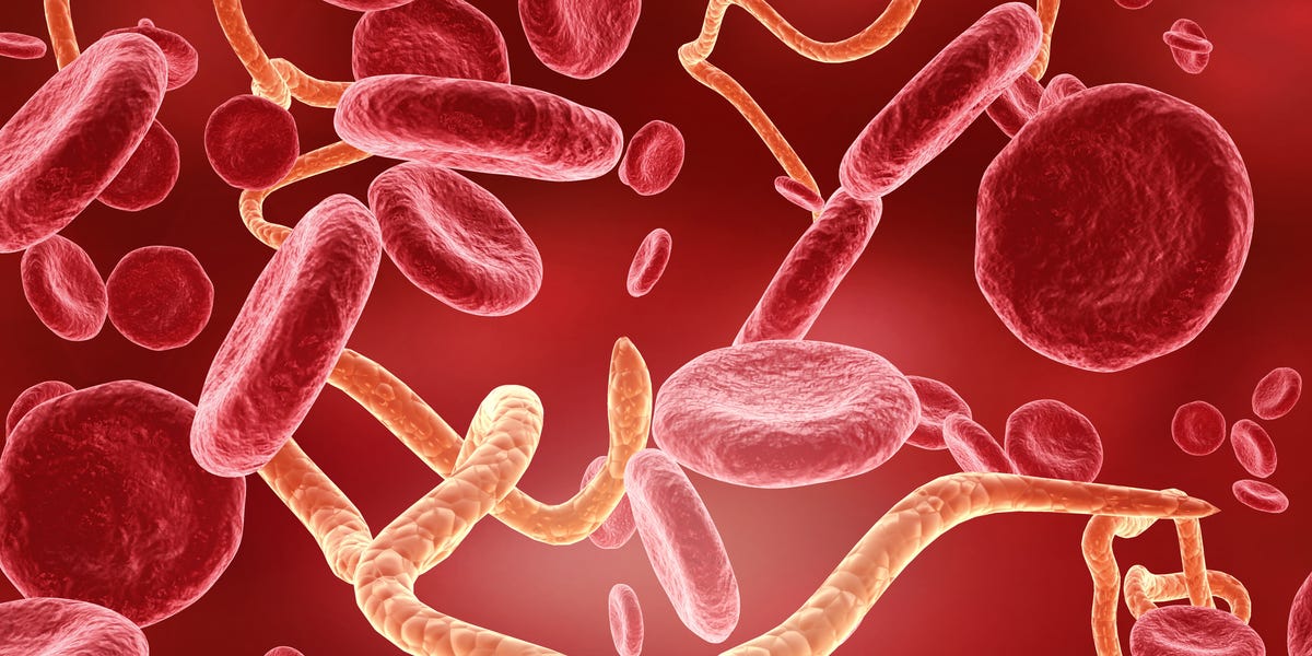 Come si diffonde il nuovo ceppo di Ebola? Il Bundibugyo: sintomi e ...