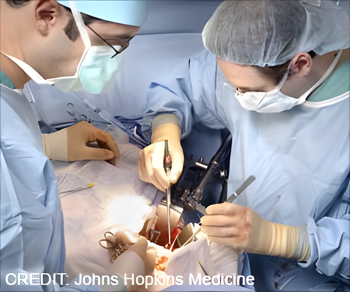 Rare quadruple organ transplant saves cystic fibrosis survivor