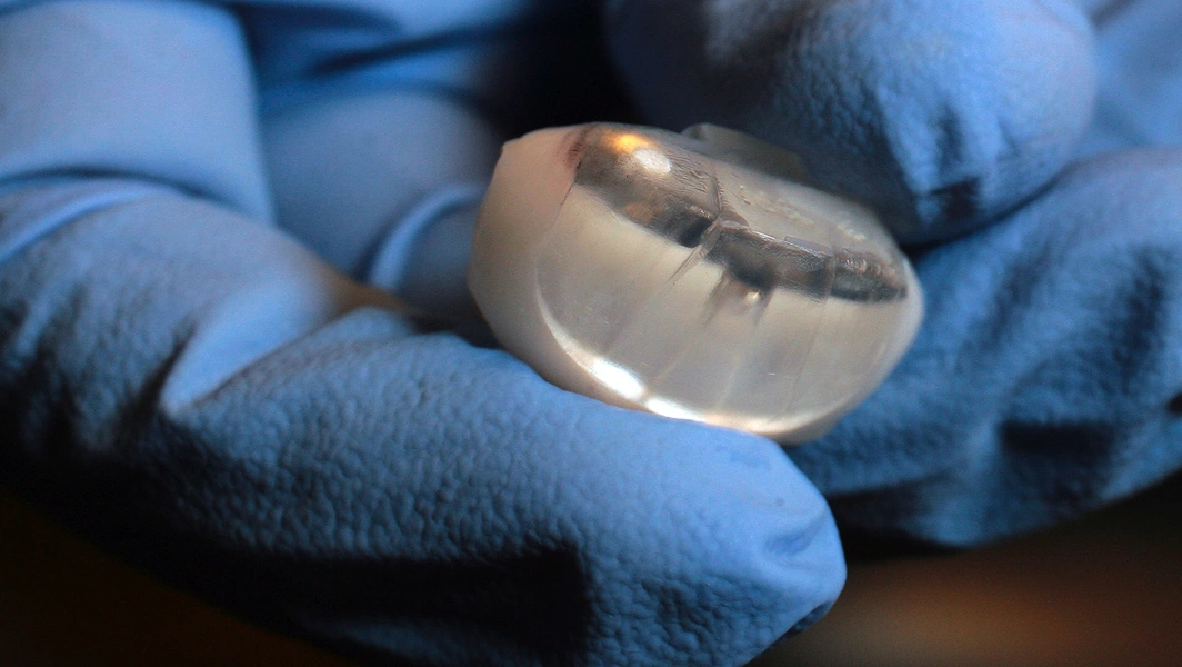 Nighttime teeth grinding decoded for healthier mornings