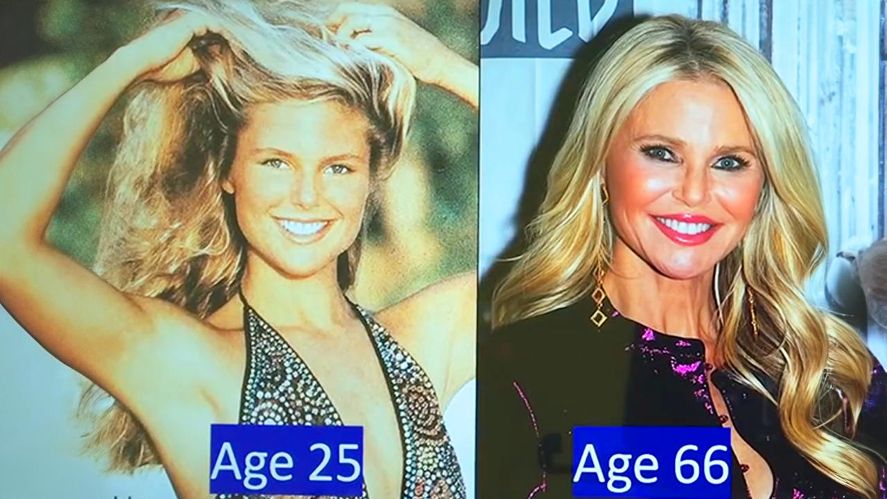 Doctor reacts to Christie Brinkley’s appearance changes