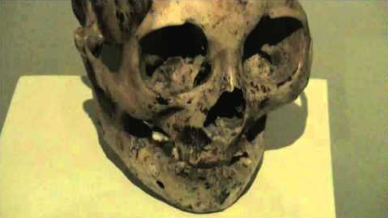 The largest elongated heads in the world