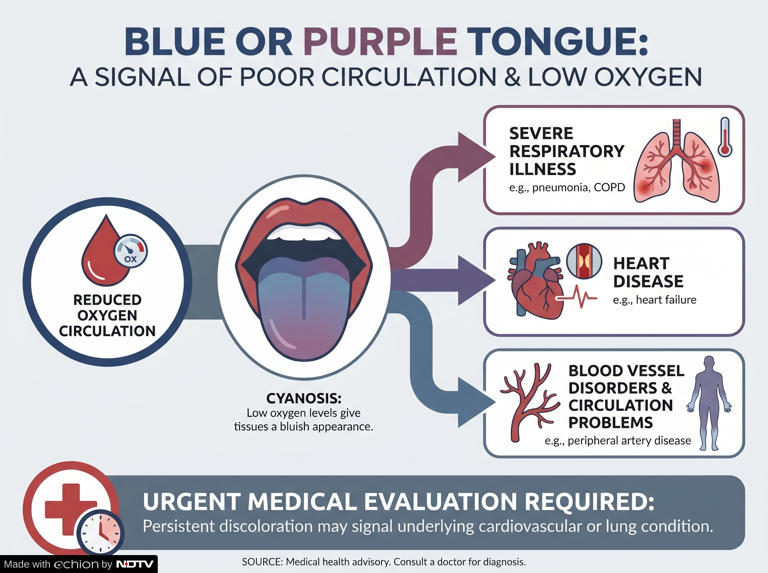 What colour is your tongue? Here's what it says about your health