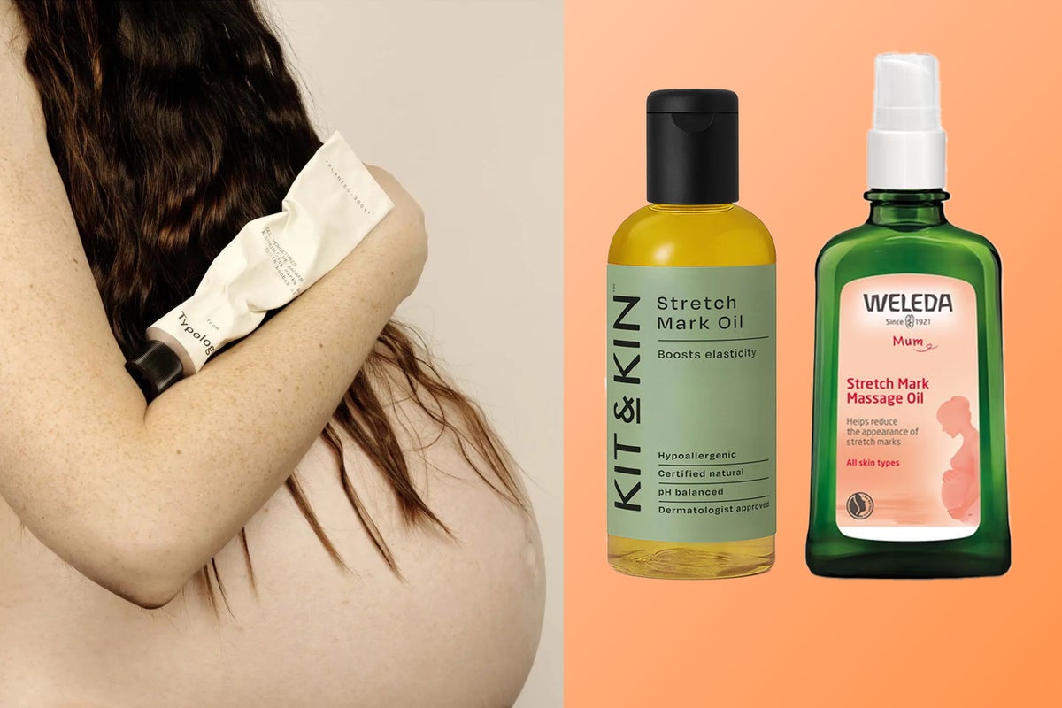 12 best stretch mark creams 2026, tested by a mum