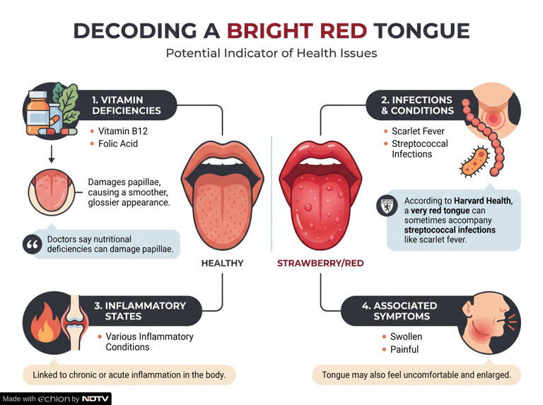 What colour is your tongue? Here's what it says about your health