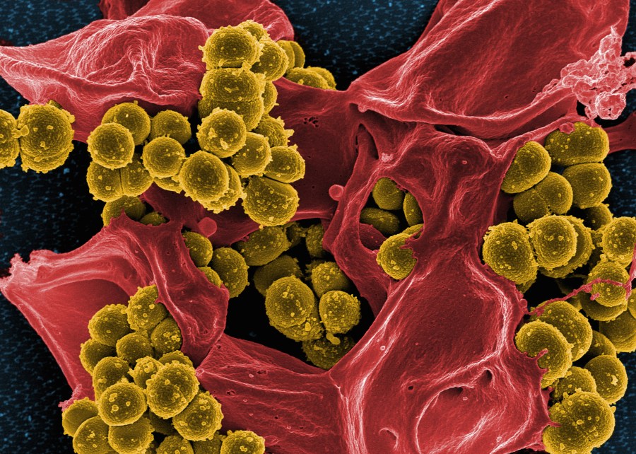 Eczema cream recalled over risk of 'life-threatening' staph infection