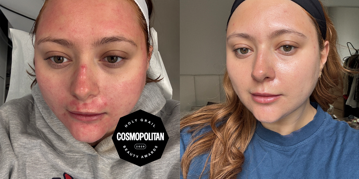My skin texture, acne scars, and dullness improved from this one ...