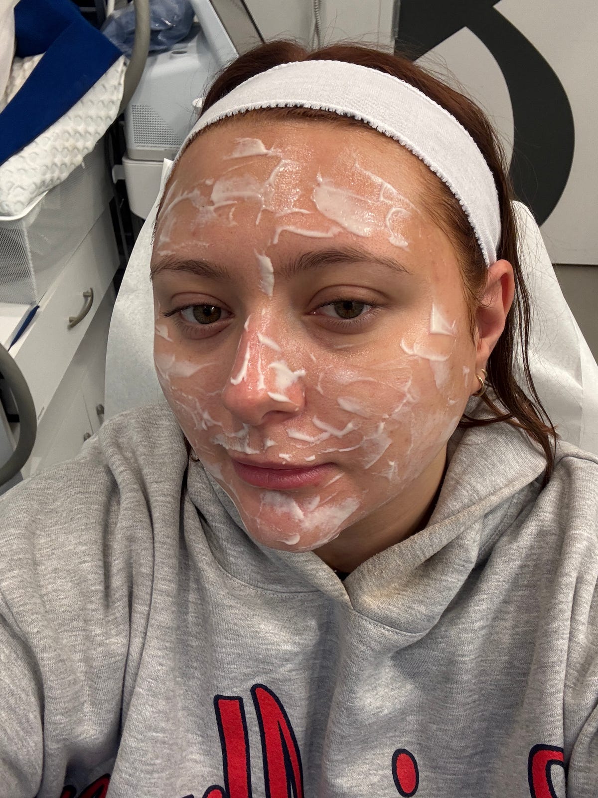 My skin texture, acne scars, and dullness improved from this one ...