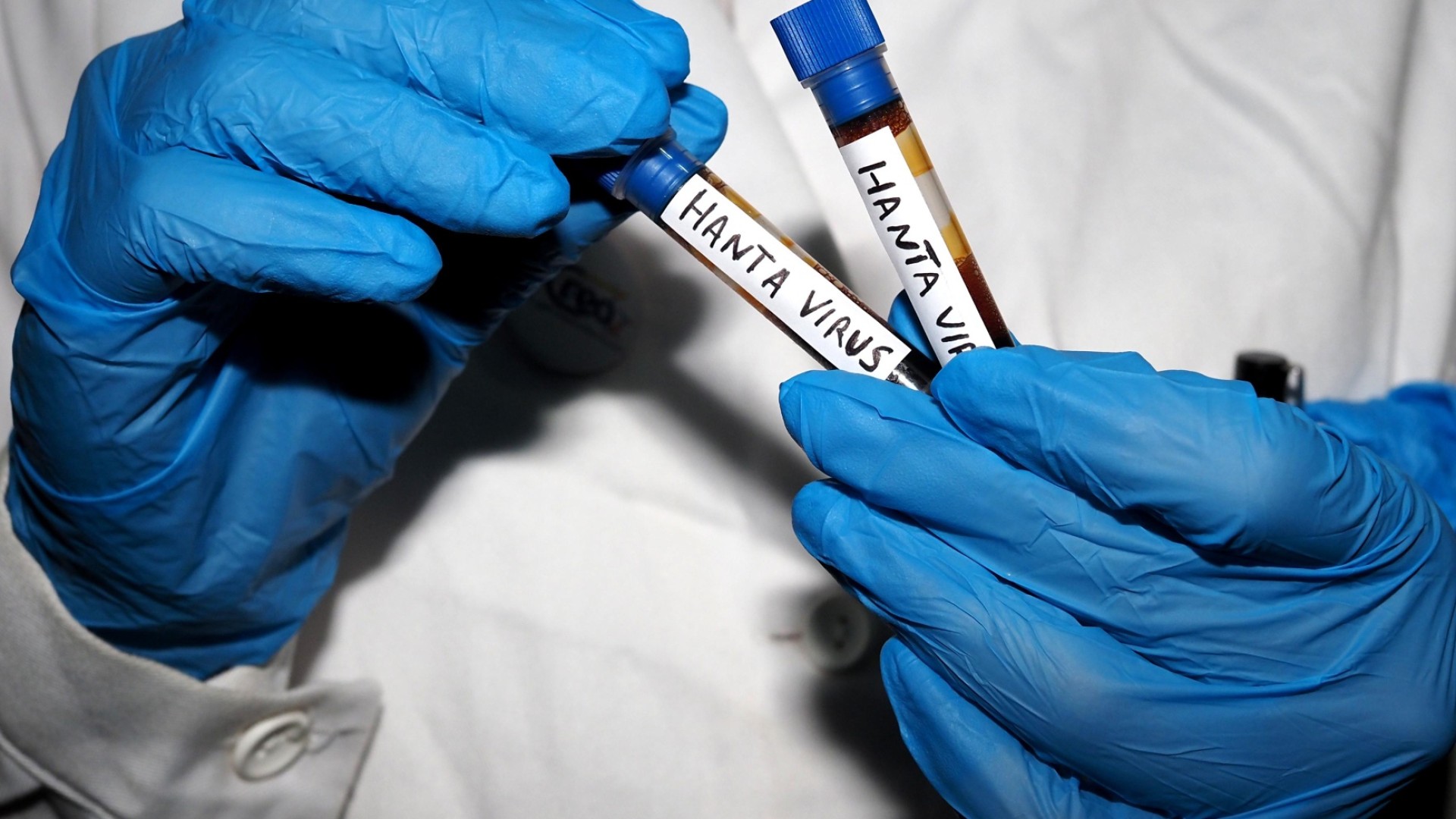 Hantavirus outbreak from cruise ship hits 11 cases, 18 Americans in ...