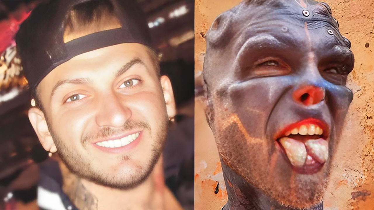 Surgeon reacts to extreme body transformations