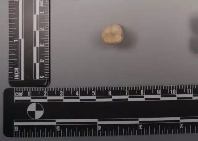 Buried for hundreds of thousands of years, ancient teeth contained a ...