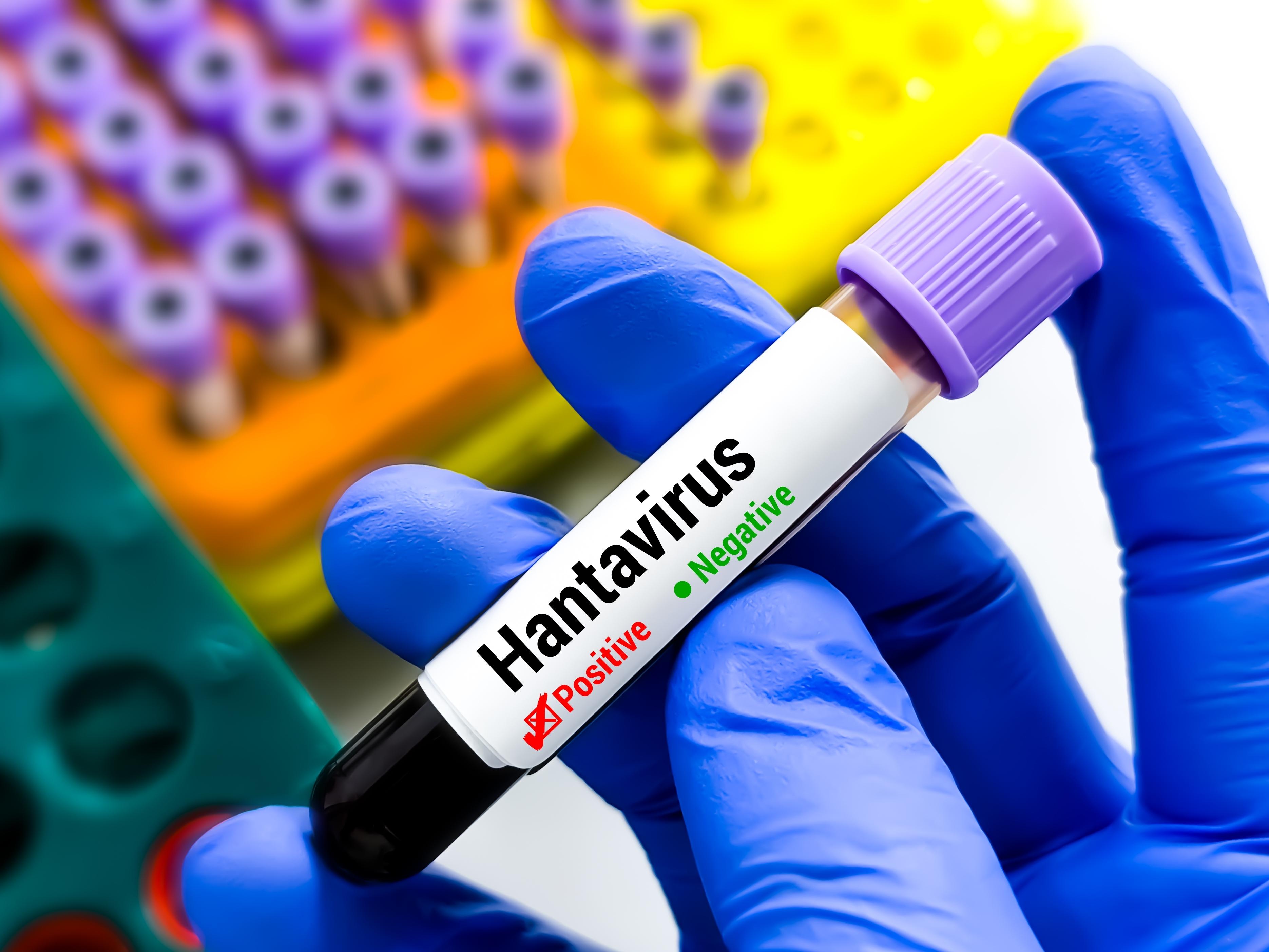 Hantavirus protocol breach forces hospital employees into 6-week quarantine