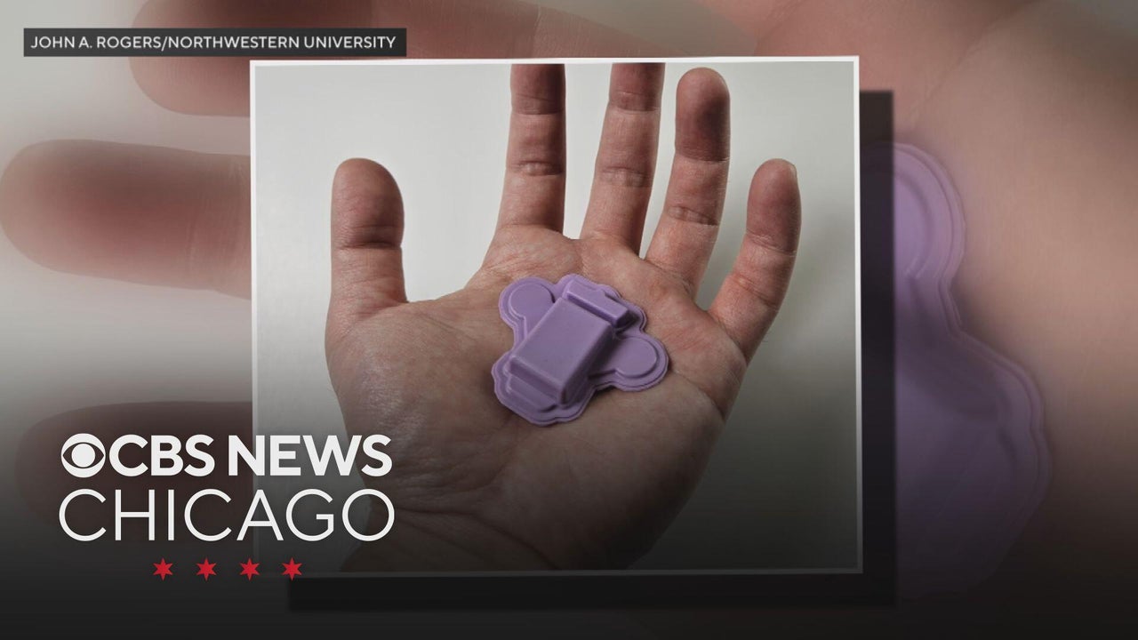 Wearable polygraph detects hidden stress
