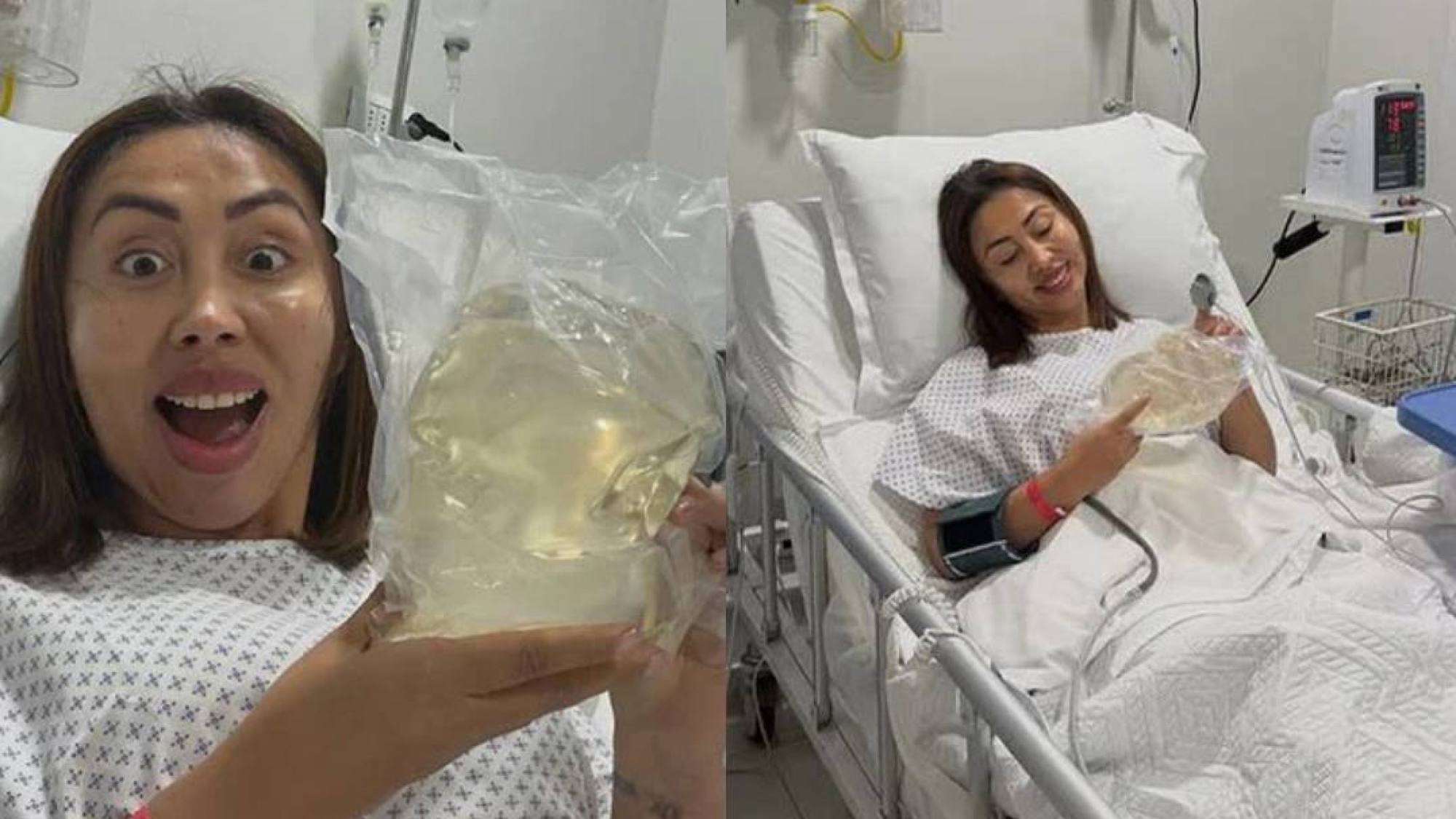 “Me acomplejaban”: Naya Fácil impacta al revelar que redujo sus ...