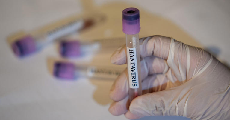 CDC says there are no US hantavirus cases currently, 41 people being ...
