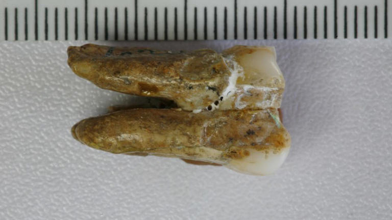 What proteins in prehistoric teeth reveal about Stone Age sex between ...
