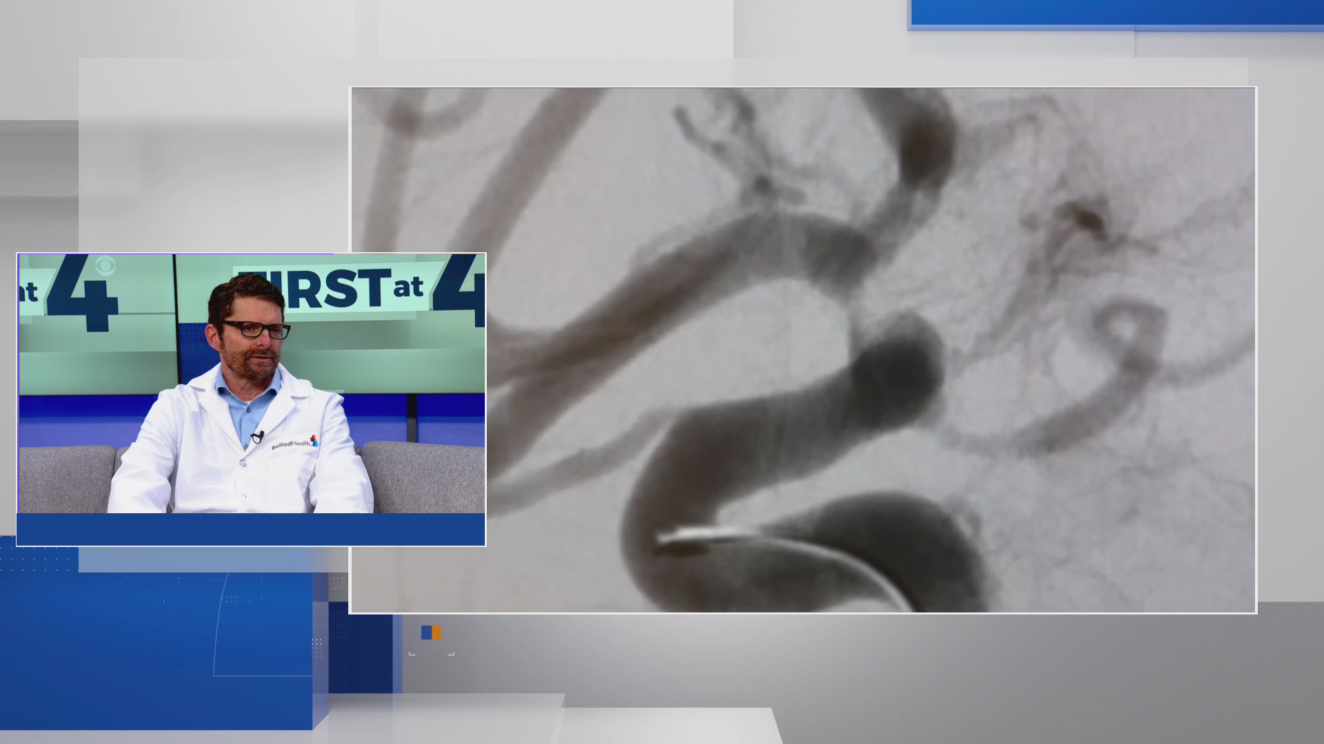 Ballad Health on Stroke Awareness Month