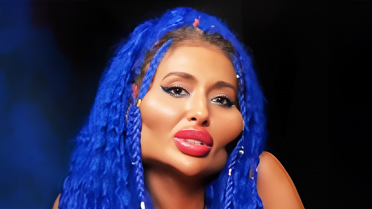 Plastic surgeon reacts to botched plastic surgery