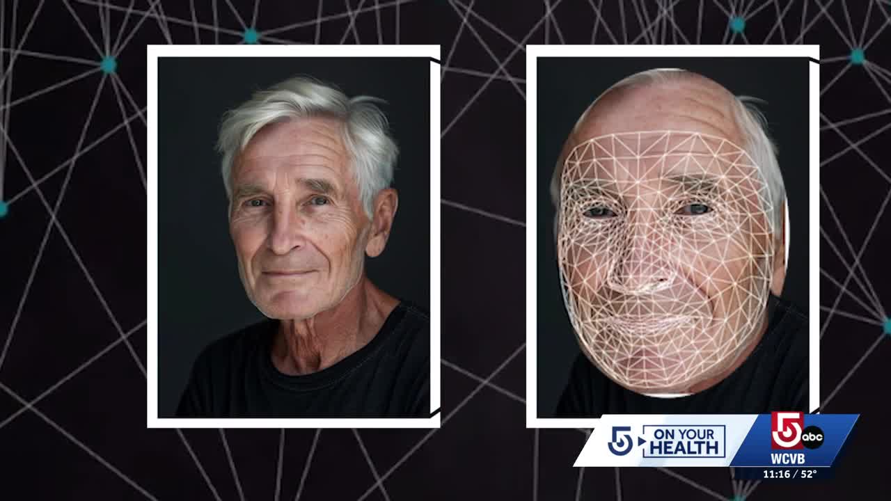 Boston researchers use AI selfies to estimate biological age, health risks