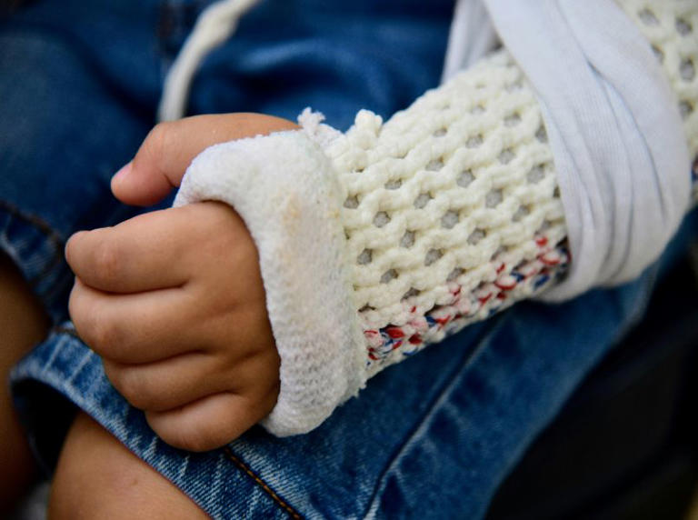 Dit zijn de meest gemaakte EHBO-fouten bij kinderen