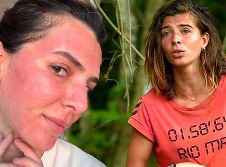 Survivor Merve Aydın’ın değişimi şaşırttı! Yüzüne yaptırdığı işlemi tek ...