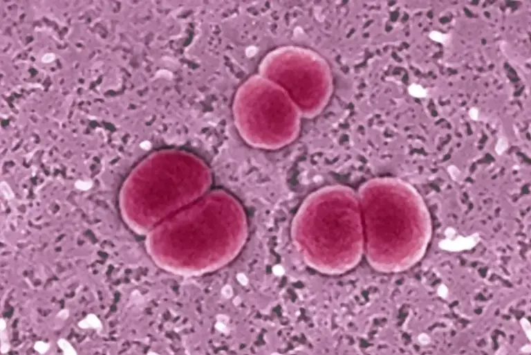 Meningitis cases confirmed among pupils at two Reading schools after ...