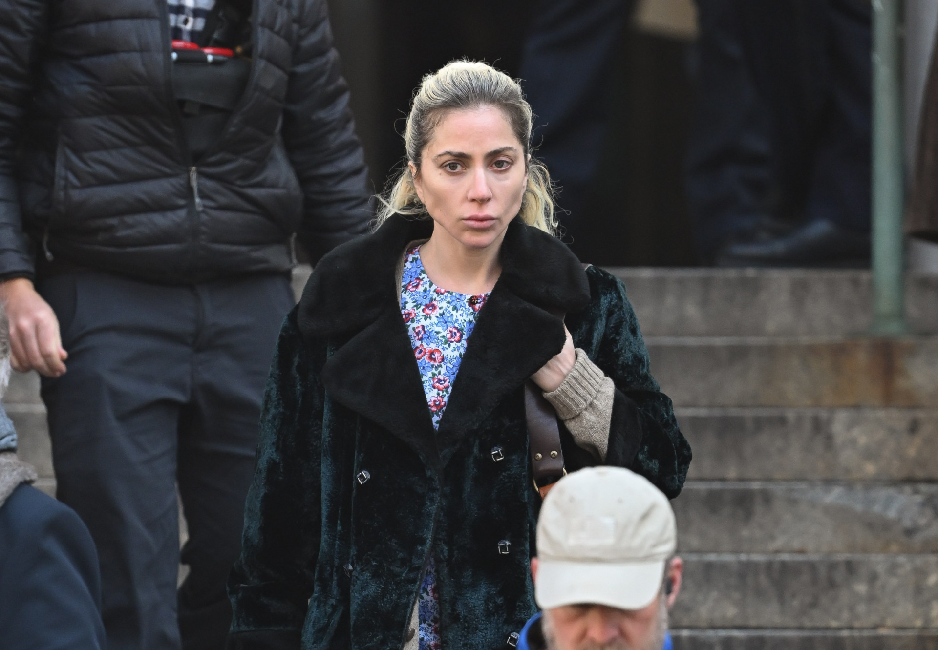 Lupus: Understand the mysterious disease affecting several celebrities