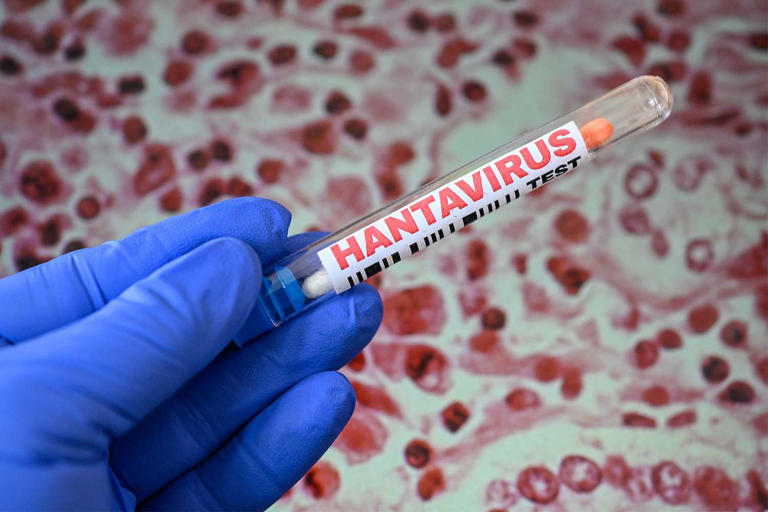 Hantavirus Death Confirmed In Colorado As Health Officials Launch