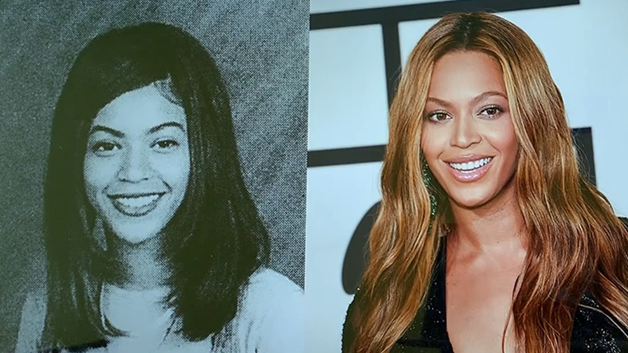 Cosmetic surgeon reacts to Beyoncé’s appearance transformation