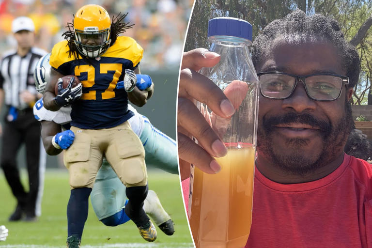 Former Packers Pro Bowler Eddie Lacy shares new look in photo after ...