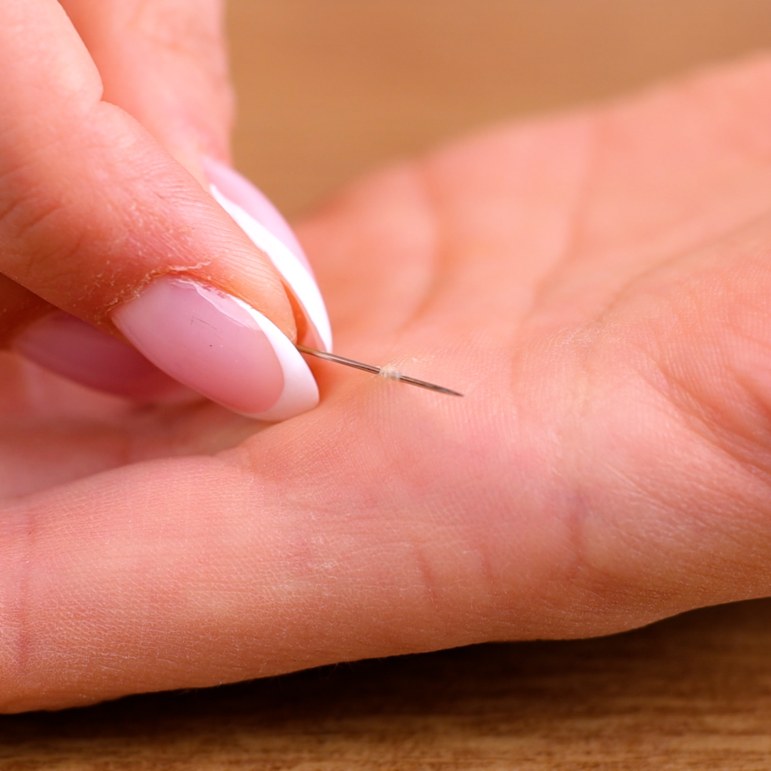 Stuck splinter gets removed easily