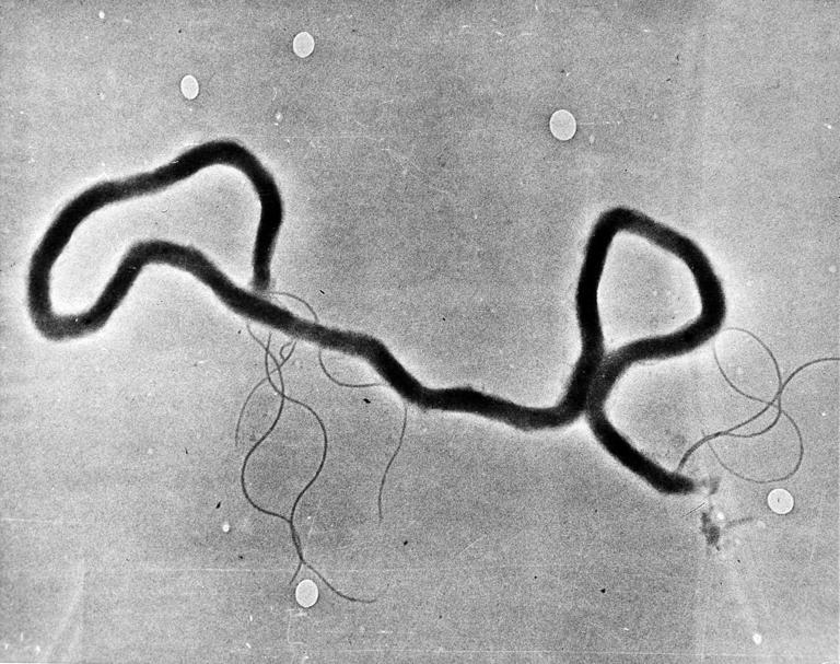 Women now account for most new cases of syphilis in the NWT., says ...