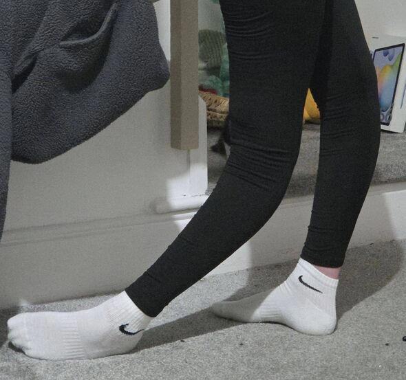 My legs are stuck at 45 degrees and baffled doctors want to amputate them