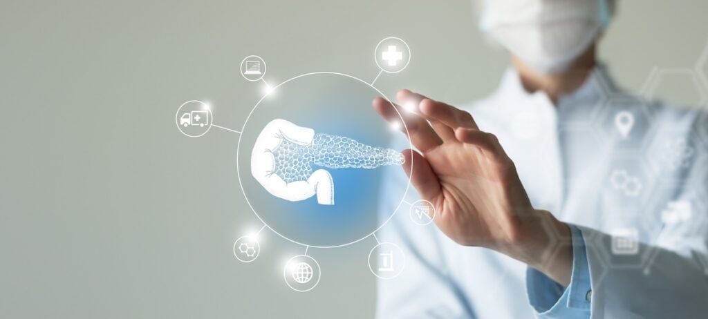 Cancer centers race to access Revolution Medicines' pancreatic cancer ...