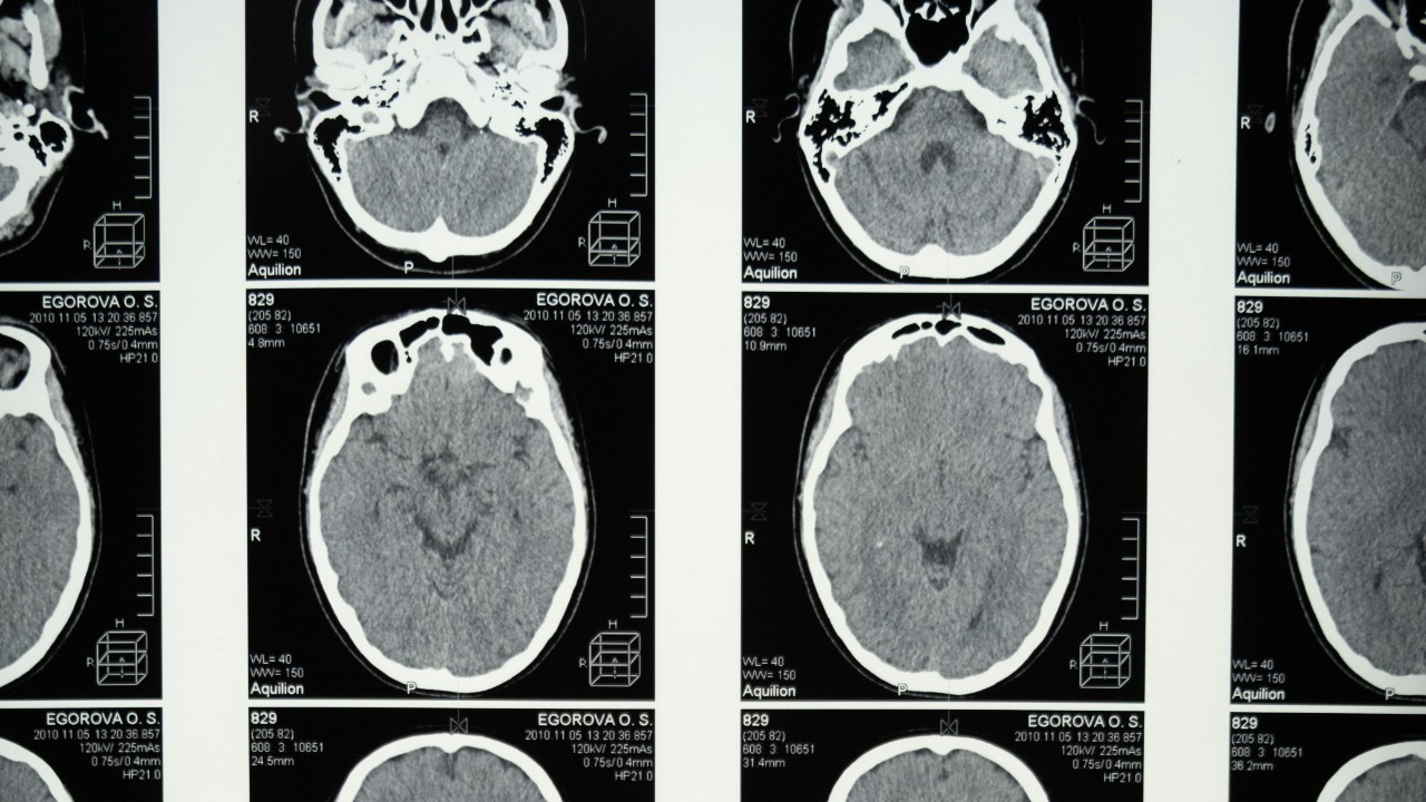 The tiny pauses and 'ums' in your speech may reveal far more about your ...